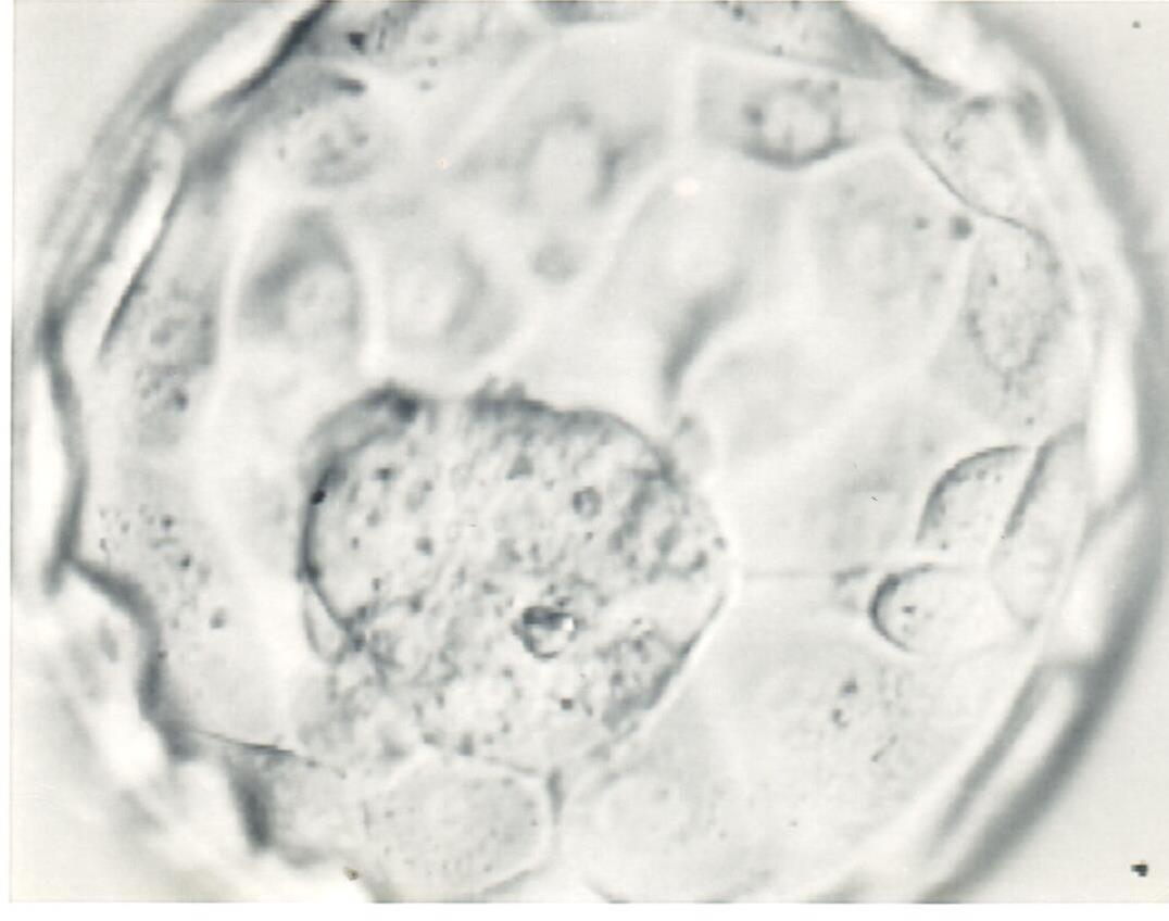 Embryo Freezing | IVF Procedure | Family Fertility Center PA